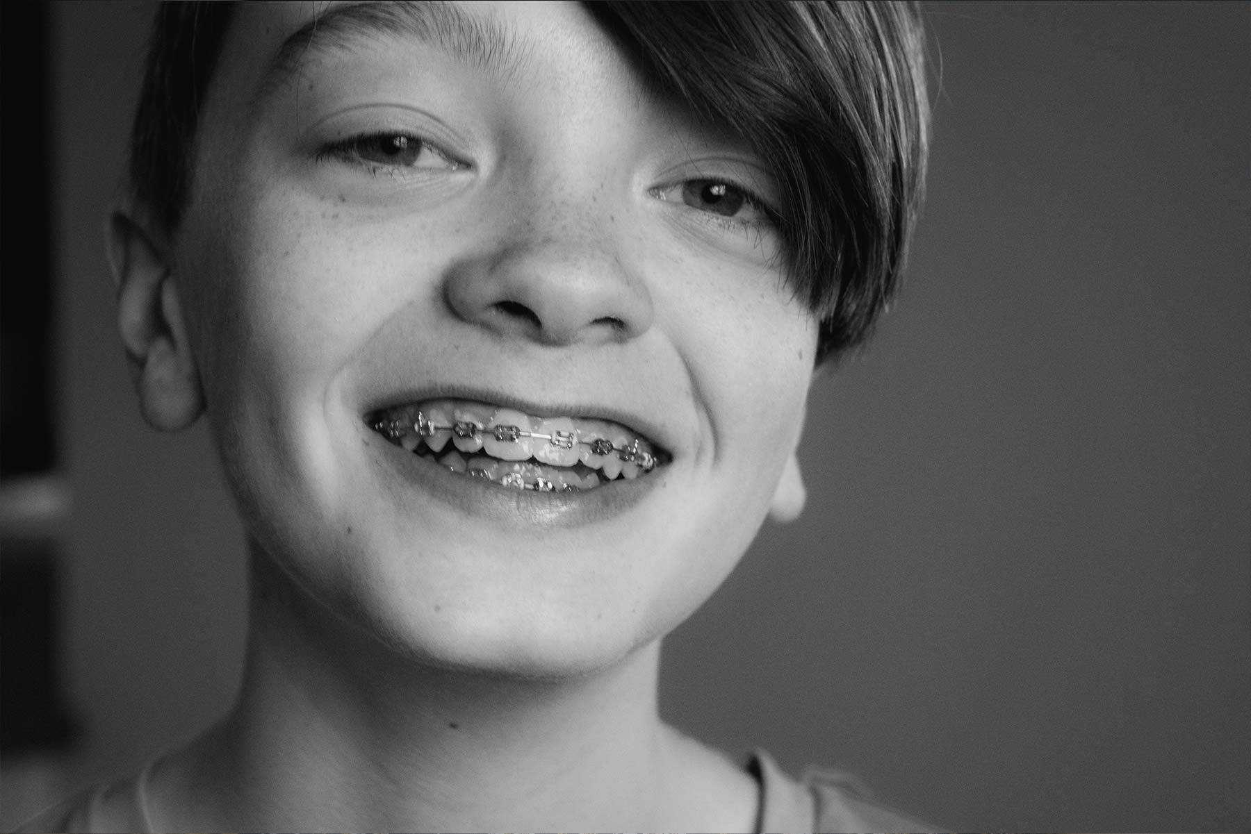 Traditional Dental Braces | Cleveland Dental Institute